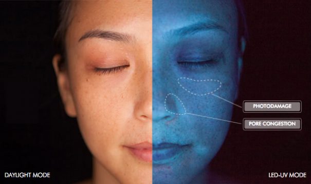 Get an Inside Look at Your Skin with SkinScope | Dr. Movassaghi